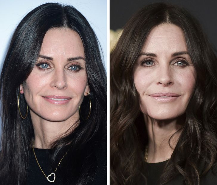 18 famosos que fizeram procedimentos estéticos e mudaram muito
