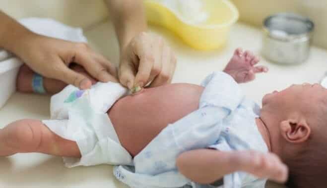 Umbigo do bebê, cuidados e dicas para evitar problemas