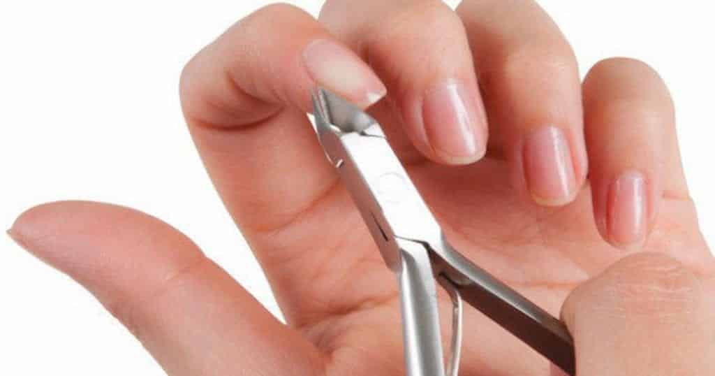 Paroníquia – O que é, causas, sintomas e tratamento