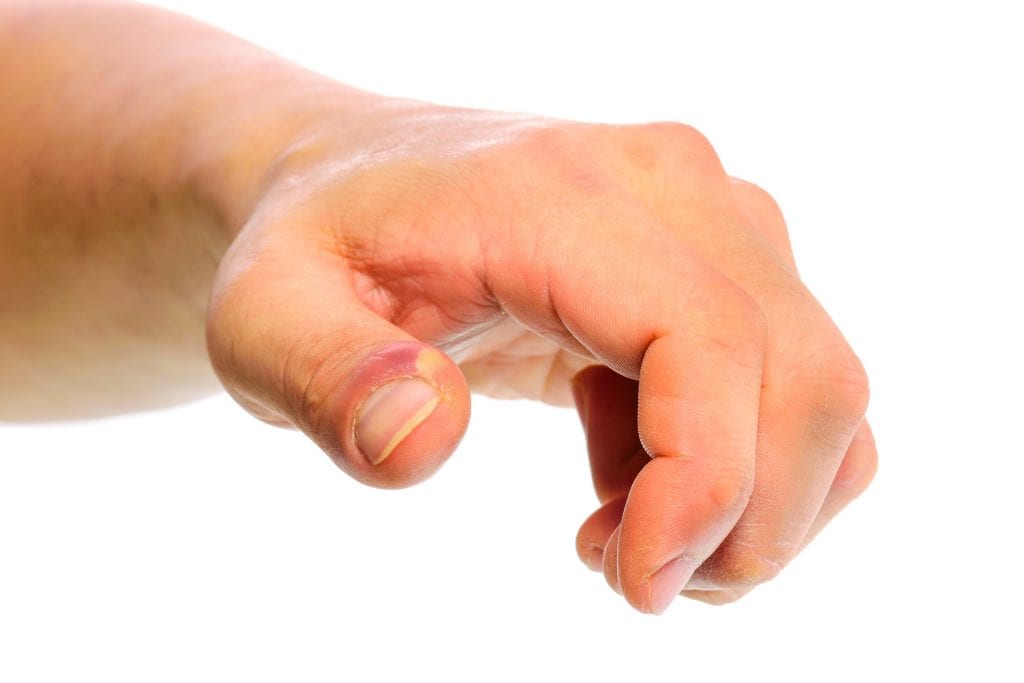 Paroníquia – O que é, causas, sintomas e tratamento